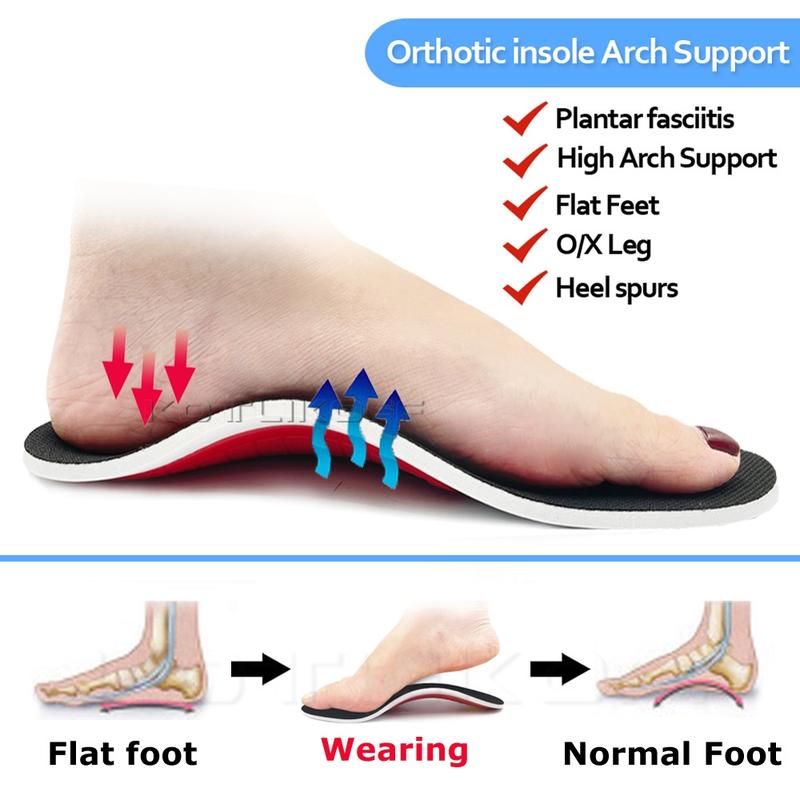 1 Pair Advanced Orthopedic High Arch Support Insoles 3D Arch - TikTok ...