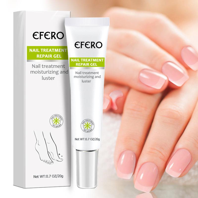 Nail exfoliating plant nail lotion nail cream care gel moisturizing ...