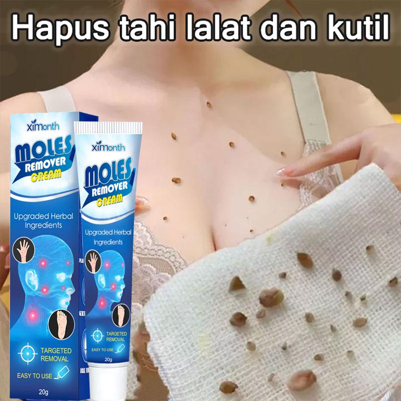 Ximonth ยาทาหูด 20g หูดและติ่ง แคลลัสและรากหนาม ช่วยให้หูดหรือตาปลาหลุดออก - TikTok Shop Thailand