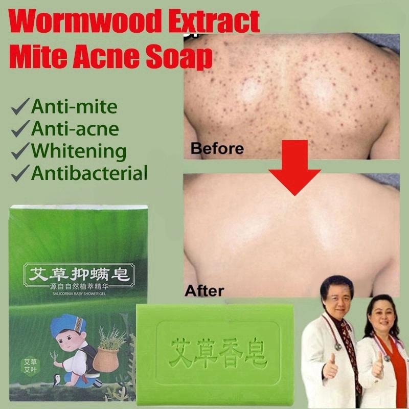 Wormwood Mite Acne Soap Psoriasis Anti Fungal Itching Sulfur - TikTok ...