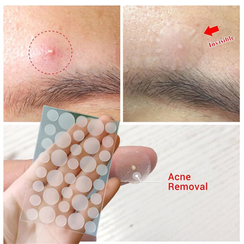 24/36 in 1 Invisible Acne Pimple Patches - Breathable, Waterproof ...