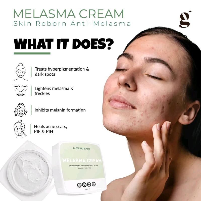 Glowing Mark | Melasma Cream with 1 young white soap - TikTok Shop ...