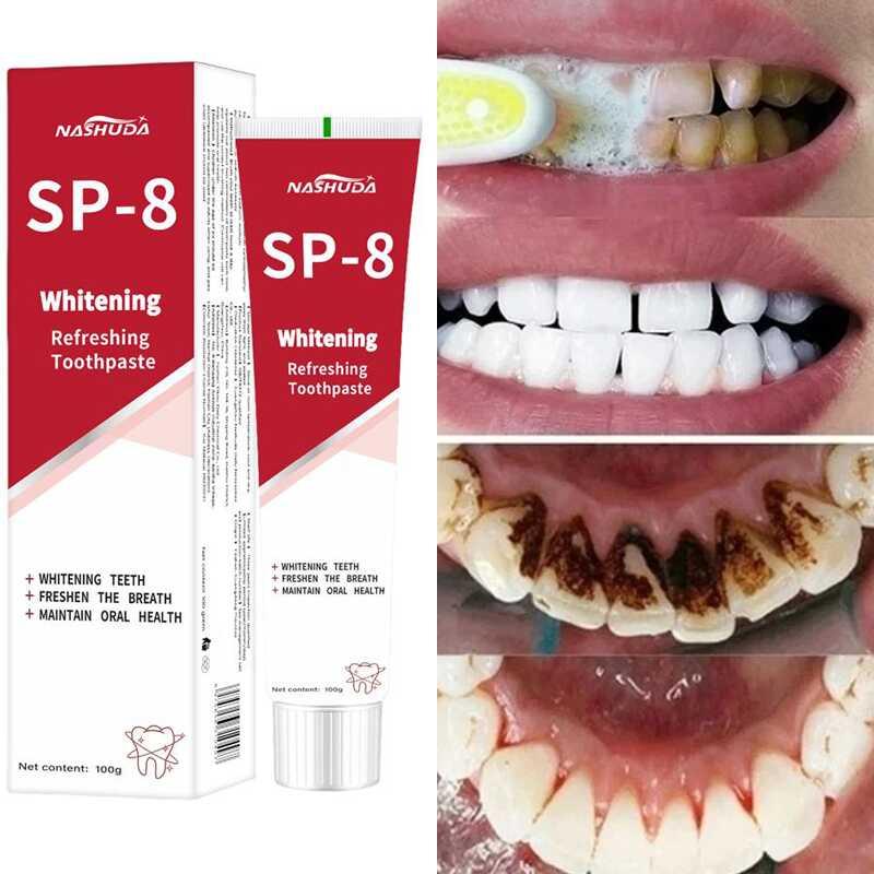 Ubat Gigi Probiotik, SP 8, Memutihkan Gigi Bersih, Menghilangkan ...