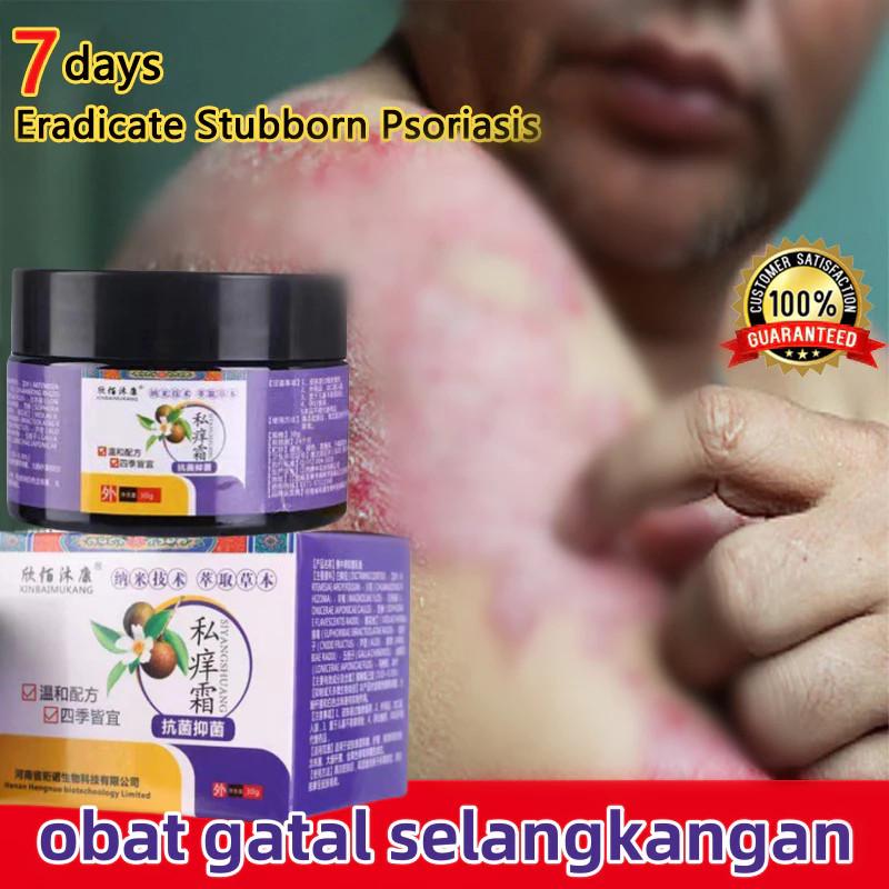 Salep Gatal Paling Ampuh Obat Salep Kulit Jamur Dermatitis Psoriasis ...