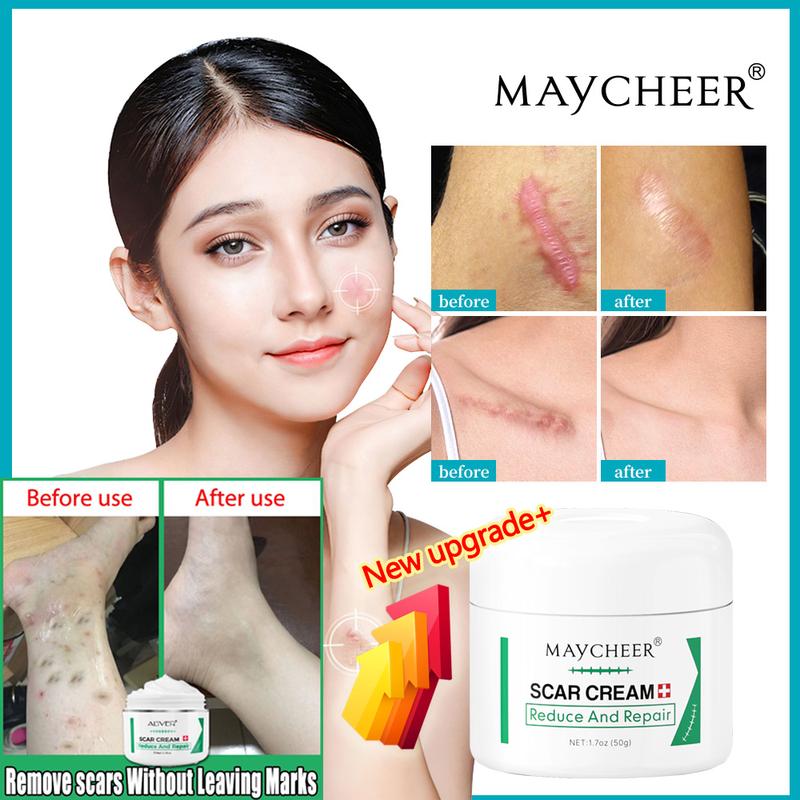 【safety certificate】Scar repair ointment to dilute acne marks, - TikTok ...