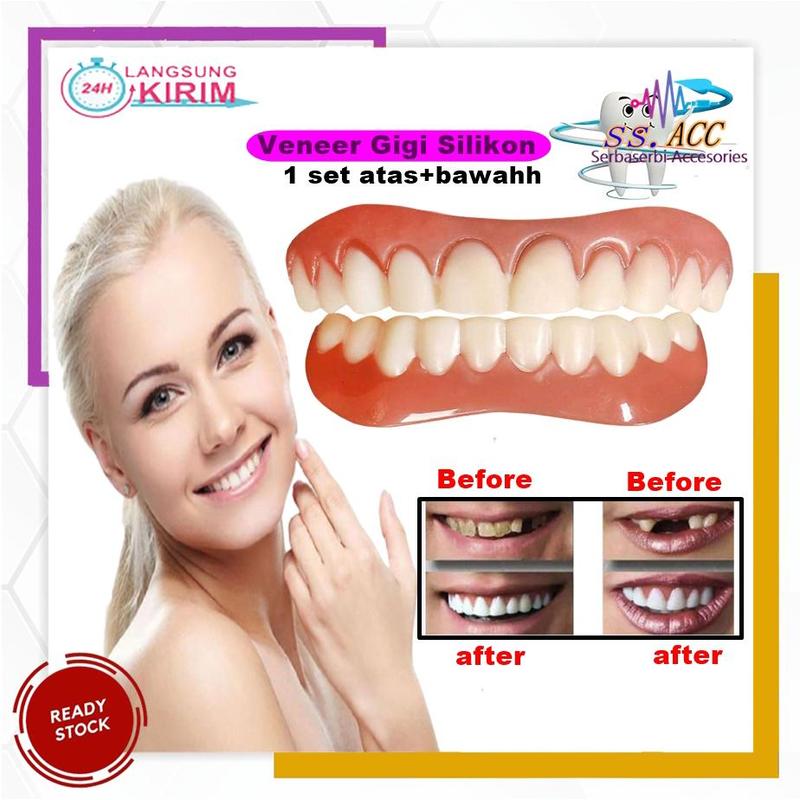 [Kualitas Terjamin] Simulasi Veneer Gigi Silikon, (Rahang Atas + Rahang ...