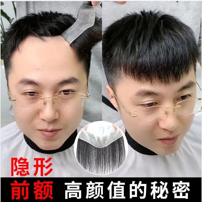 Rambut palsu garis rambut lelaki, tampal rambut, penggantian - TikTok ...
