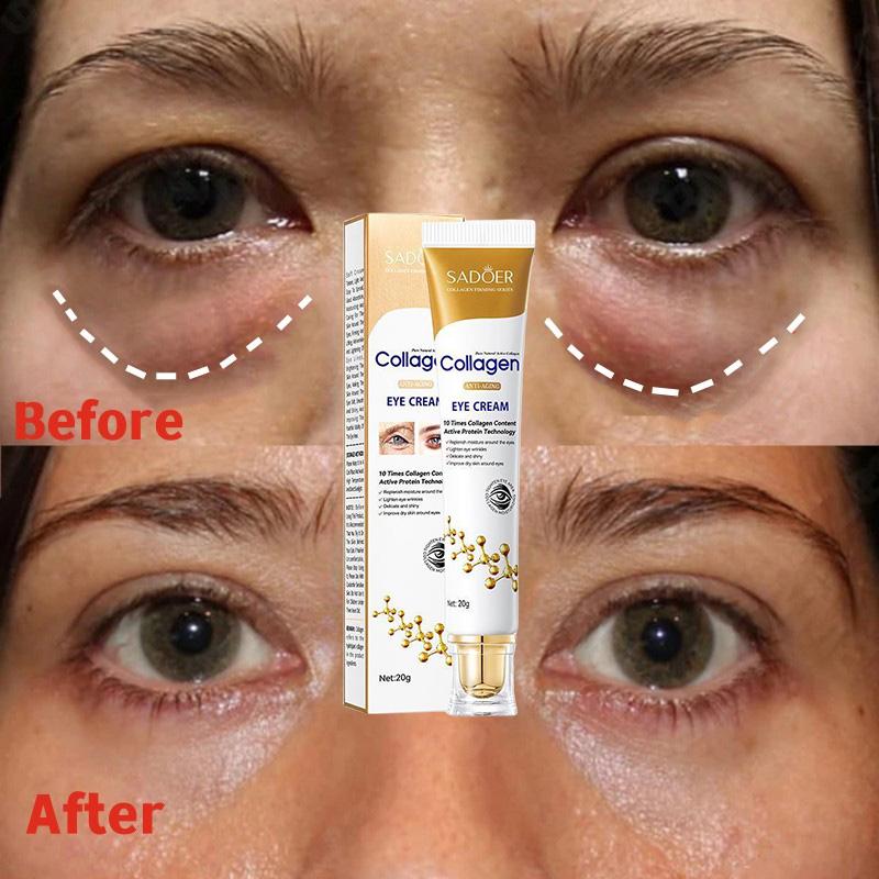 Instant Eye Bag Removal Cream Removal Wrinkles Firming Skin Collagen ...