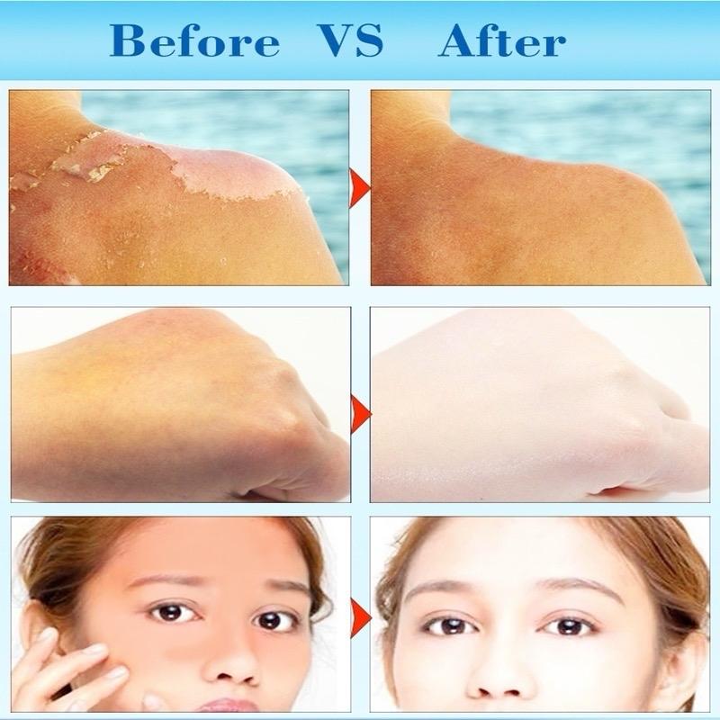 SUNBLOCK SPF118+ Light Gel 118ML (Face & Body) Sunscreen Protection ...