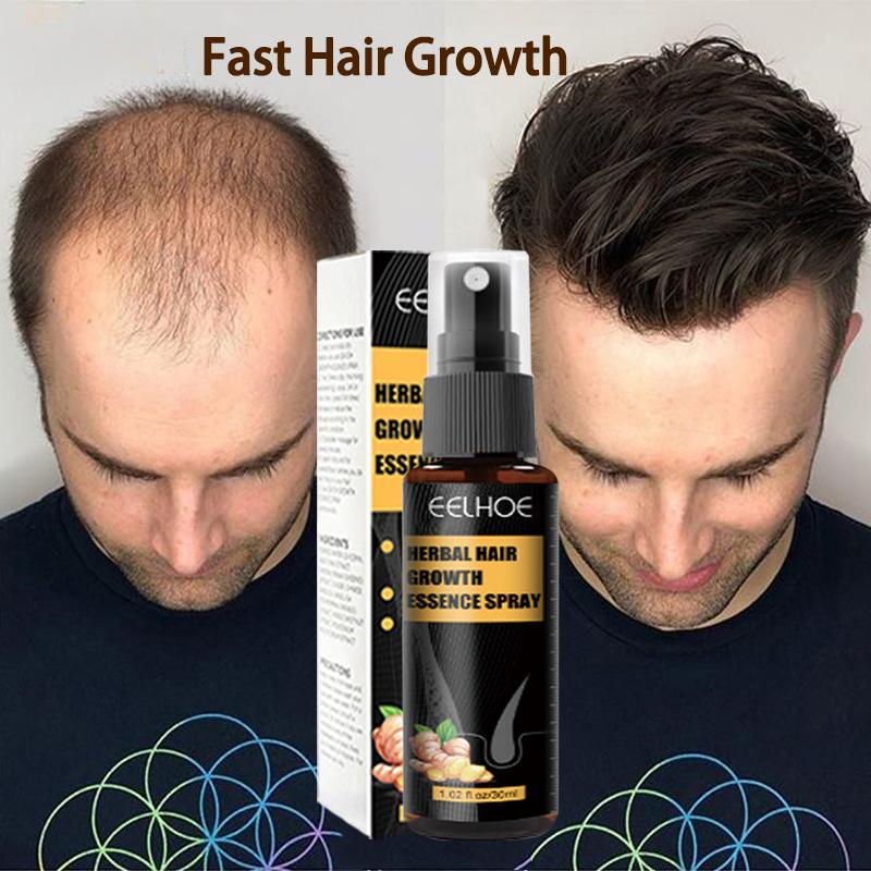 7 Days Fast Hair Growth Hair Grower For Men Original Regrow Ginger ...