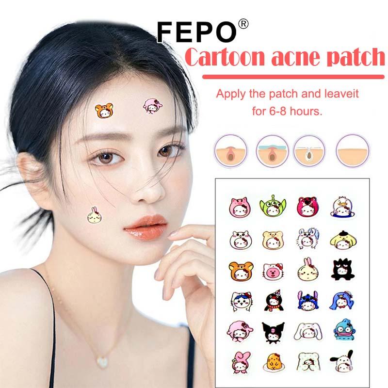 20pcs/set Cartoon Pattern Stickers Pimple Cover Skin Care Acne - TikTok ...