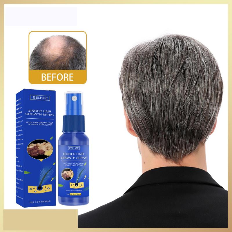 Ginger Dense Hair Spray Scalp Massage Moisturizing Thick Hai - TikTok ...
