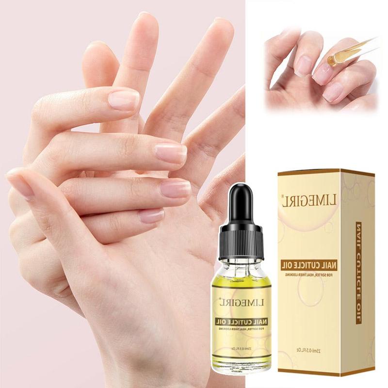 Nail Plant Nutrient Oil Anti Backstabbing And Dead Skin Removal ...