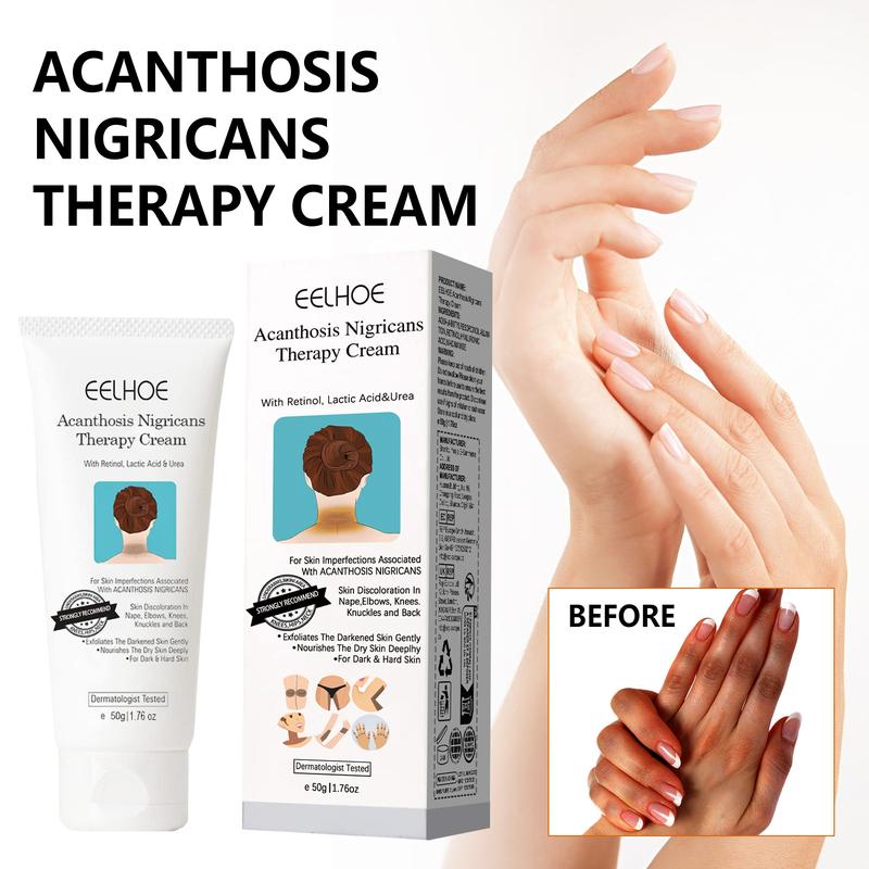 Nigre Acanthosis Nigricans Cream Repair Cream Hydrating Moisturizing ...