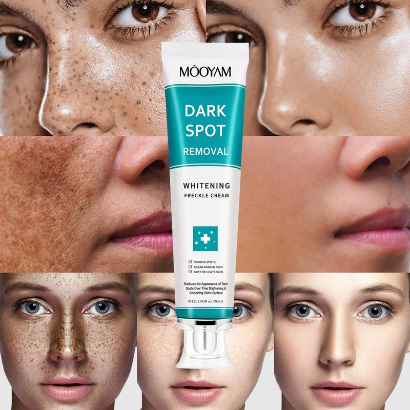 Dark spot removal cream black spot cream whitening freckle cream ...
