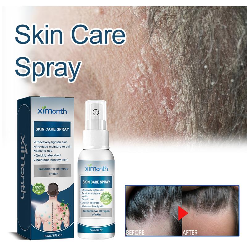 XIMONTH Folliculitis Scalp Spray, Psoriasis & Folliculitis, Antifungal ...