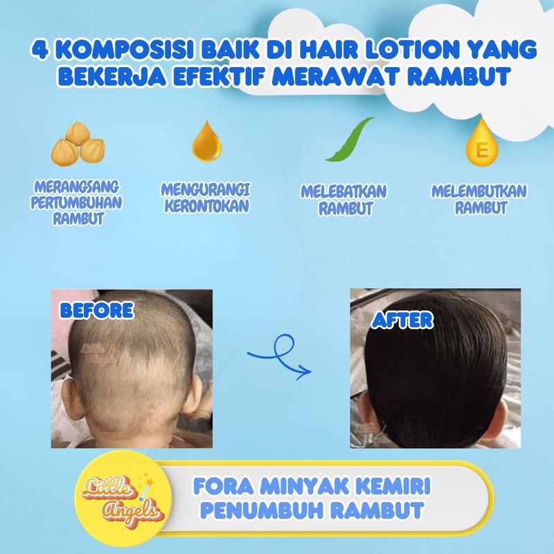 Fora Natures Minyak Kemiri 65Ml Penumbuh Rambut Bayi Baby Hair Growth ...