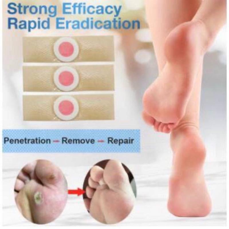 CORN PLASTER REMOVER 6Pcs skin tag remover Penghilang ketuat - TikTok ...