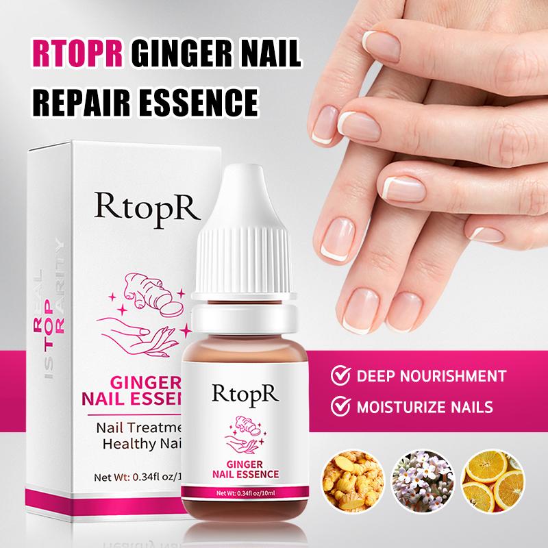 RtopR【FDA】Ginger Nail Care Essence Nail Care Anti-Infectious - TikTok ...