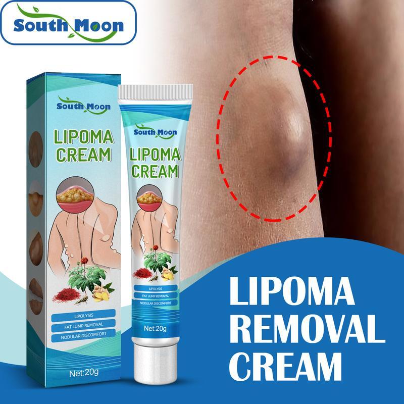South Moon Lipoma Removal Cream, Relieve Fat Caking Tumor Subcutaneous ...