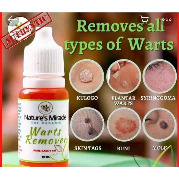 Natures Miracle Warts Remover Warts Remover Original Mole An - TikTok ...