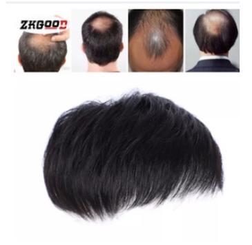 Jual Wig Botak Pria - Wig Penutup Kepala Botak Pria - Jakarta Barat ...