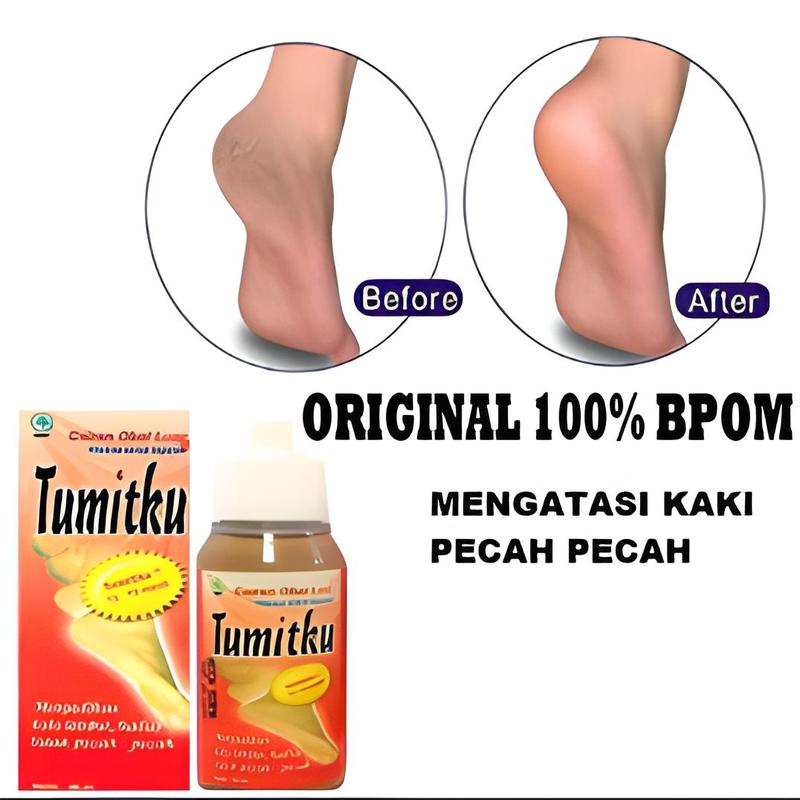 Tumitku Penghalus Kaki Pecah Kapalan Lotion - Shop | Tokopedia