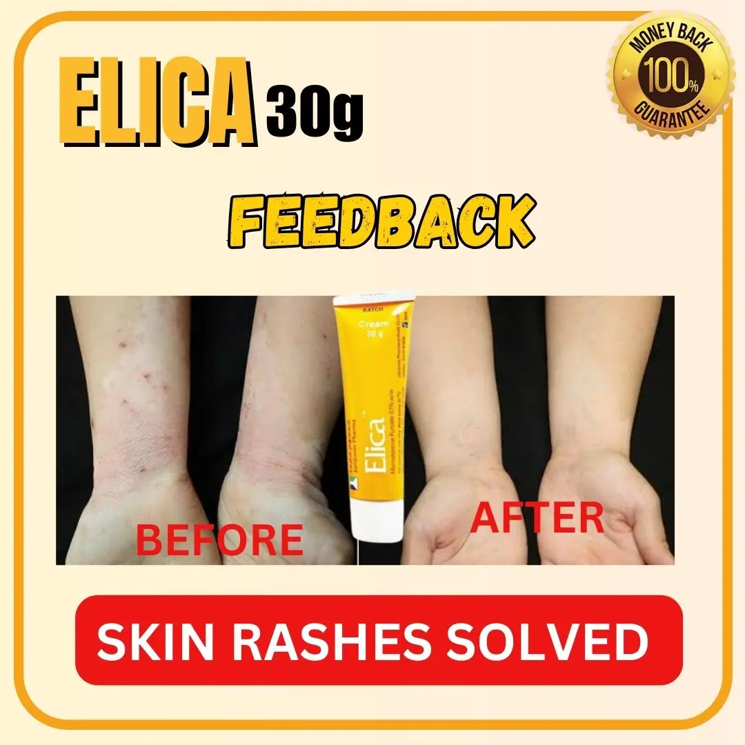Original Elica Ointment 30g Body Moisturizing Cream - TikTok Shop ...