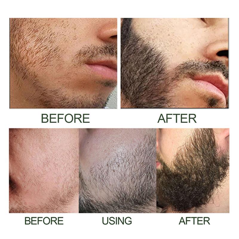 Beard Growth Serum&Beard Massage Derma Roller,Beard Care Nutritional ...
