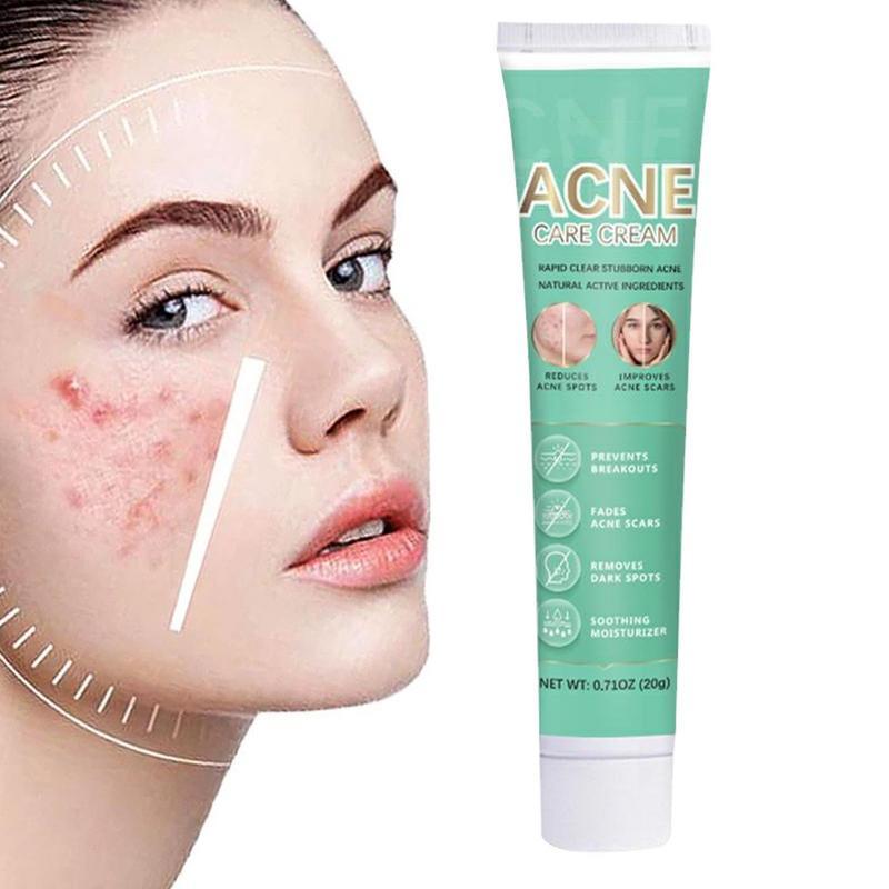 Krim Muka Penghilang Jeragat Herba, Gel Kawalan Minyak, Gel Parut ...