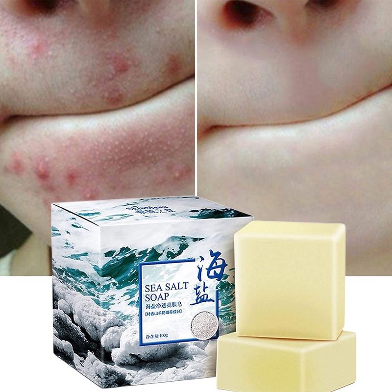 Sea Salt Soap acne Removal Pimple Pores Acne Treatment Cleaner - TikTok ...