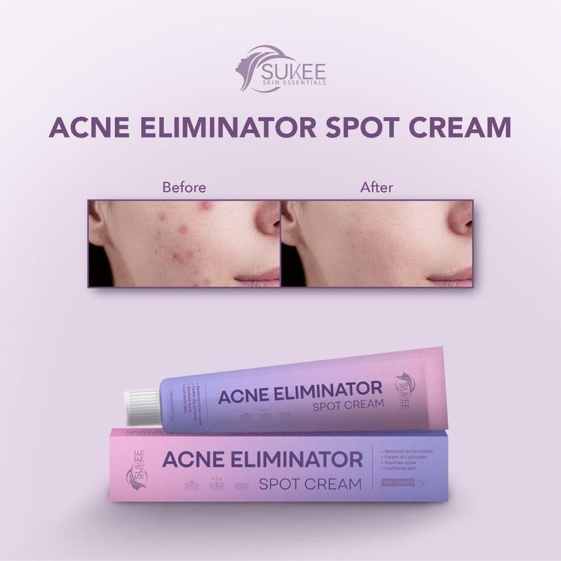 SUKEE Acne Eliminator Spot Cream 15g [COD] Salicylic Gentle Skincare ...