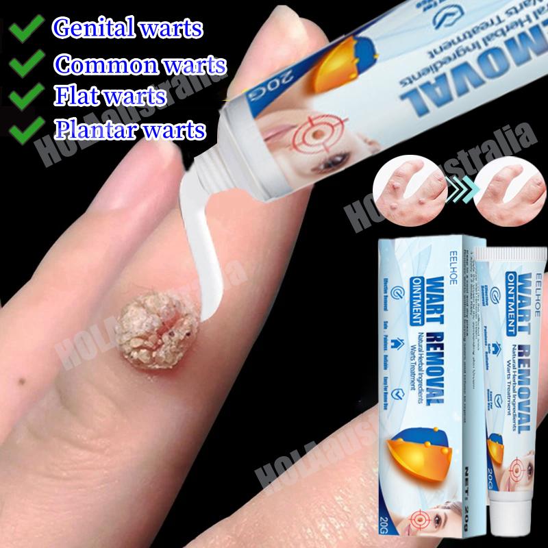 remover ointment remove wart wart wart mole seed cholesterol - TikTok ...