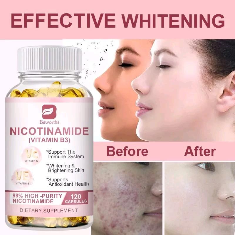 NICOTANAMIDE WHITENING CAPSULE- 120 Pcs Capsule - TikTok Shop Philippines