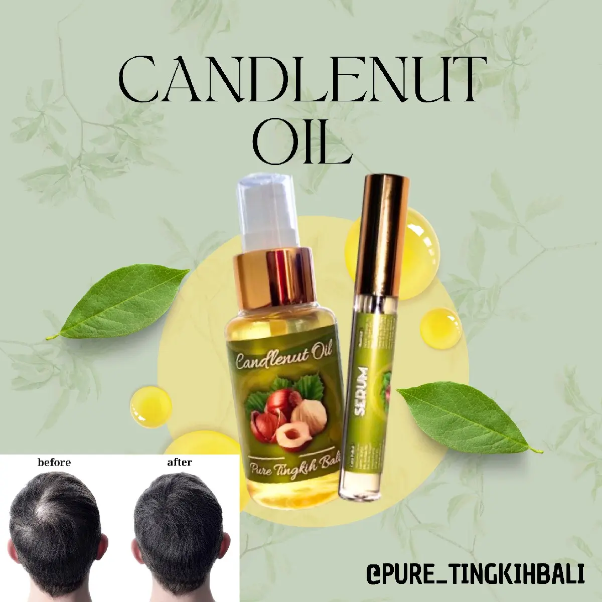 MINYAK KEMIRI BY PURE TINGKIH BALI FREE SERUM UKURAN 70ML - Shop ...
