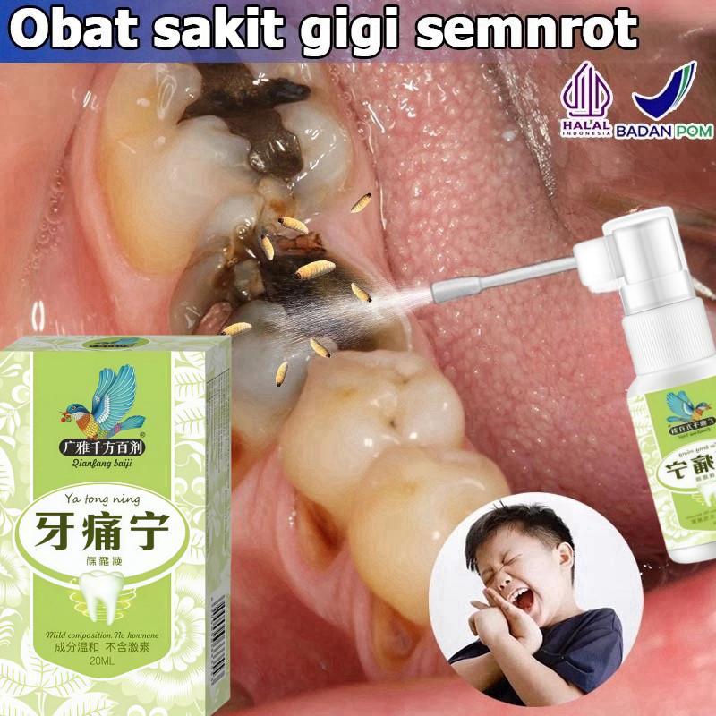Obat sakit gigi berlubang Obat sakit gigi semprot 20ml Obat sakit ...