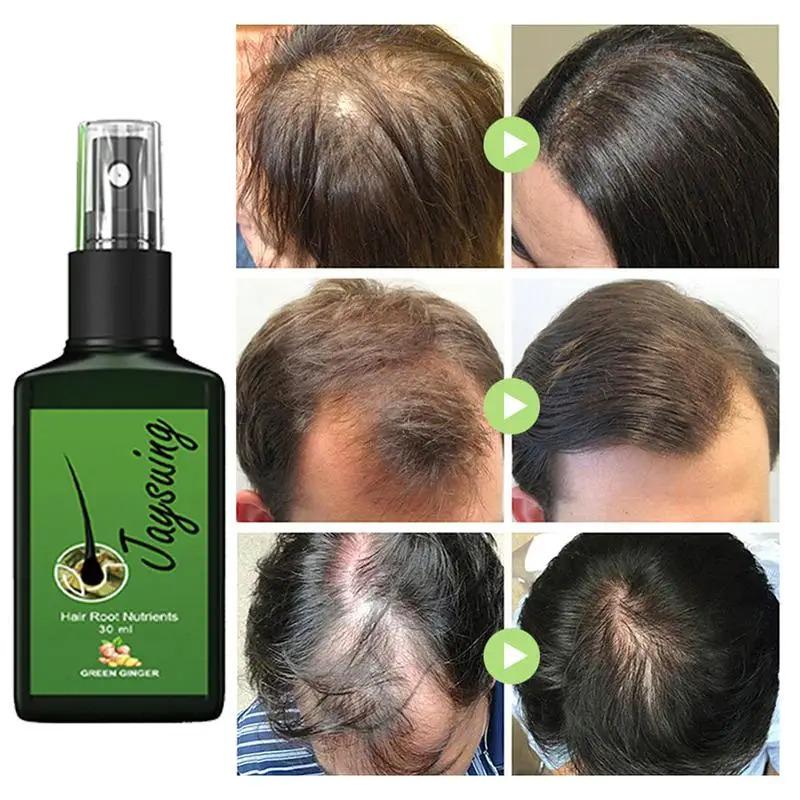 Minyak Akar Herba 120ml Semburan Rambut Anti Gugur Lelaki Wanita ...