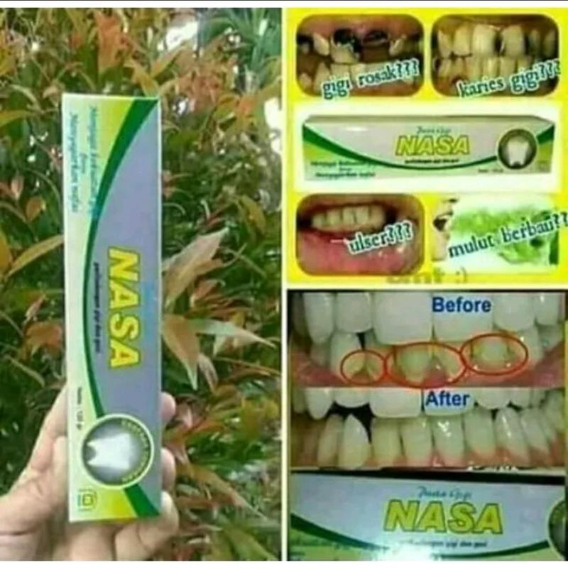 Pasta Gigi Nasa (PGN) 100% ORIGINAL Produk Herbal Alami, Memutihkan ...