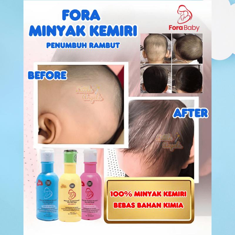 Fora Natures Minyak Kemiri 65Ml Penumbuh Rambut Bayi Baby Hair Growth ...