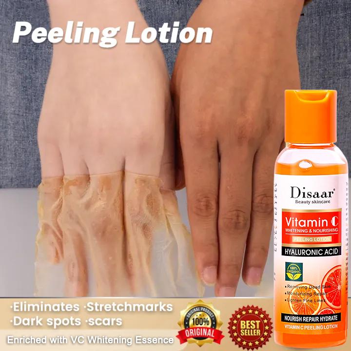 100g AZLA Vitamin C Peeling Lotion Remove Dead Skin Exfoliating ...
