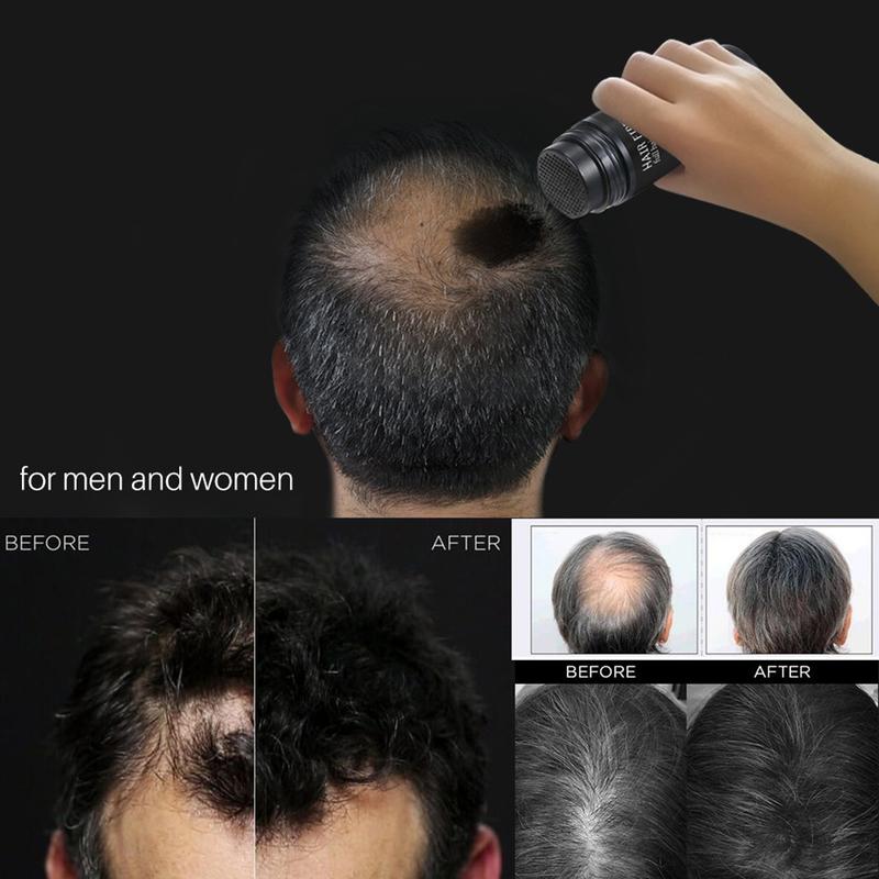 [Hu] Unisex Instant Thickening Hair Loss Building Fibers Concealer ...