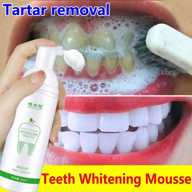 Teeth Whitening stain removal Whitening Toothpaste for teeth - TikTok ...