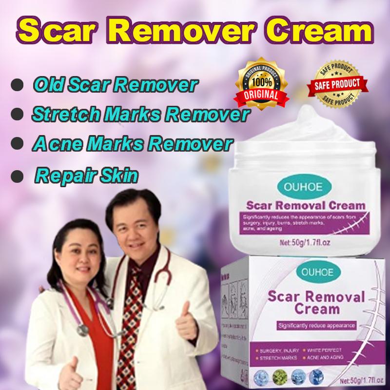 Scar Remover Cream Peklat Remover for Old Scars Legs Burn Scar - TikTok ...