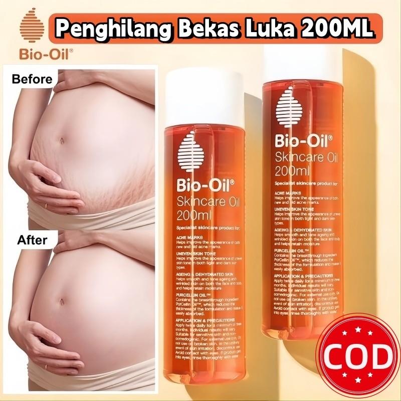 Bio Oil 200ml/Bio Oil Penghilang Bekas Luka/Penghilang Strec - Shop ...