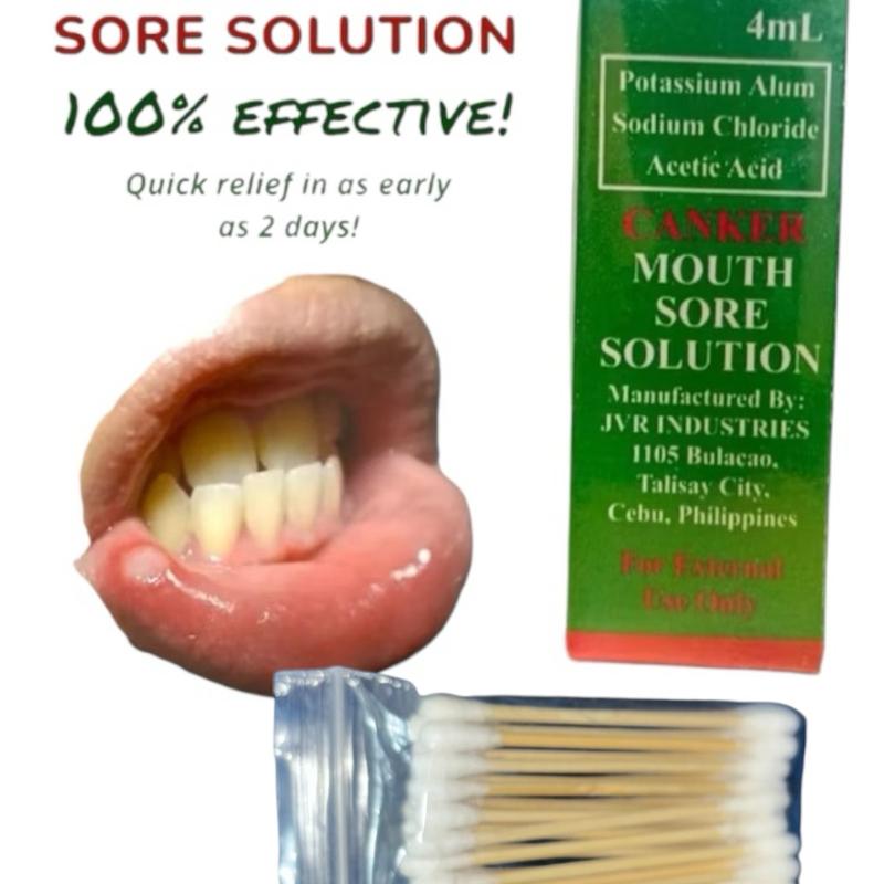CANKER MOUTH SORE SOLUTION GAMOT SA SINGAW 4ml Oral - TikTok Shop ...