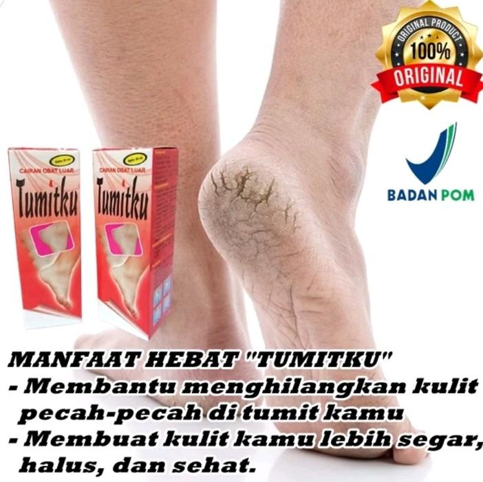 TUMITKU OBAT CAIR KAKI dan TUMIT - Shop | Tokopedia
