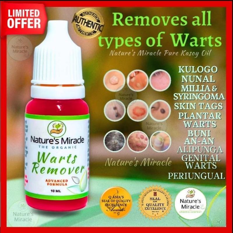 Warts Remover Kasoy Oil 15ML Nature s Miracle Warts Remover Mole ...