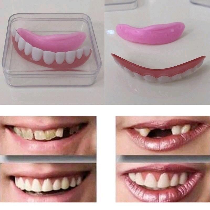 perfect smile veneers membantu penuhkan gigi, menampal gigi tak ...