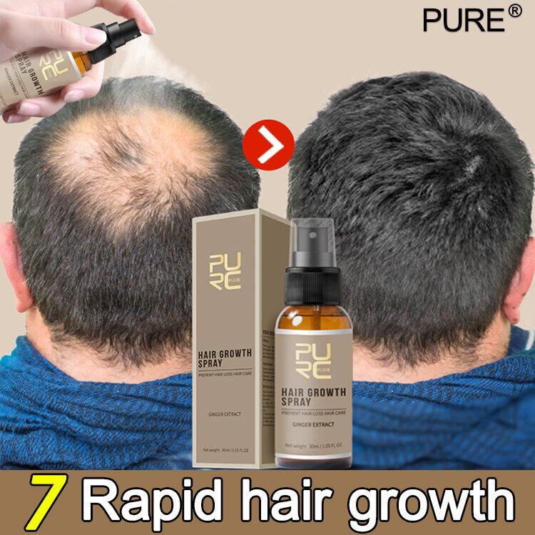 Hair growth spray 30ML natural ginger prevents hair loss an - TikTok ...