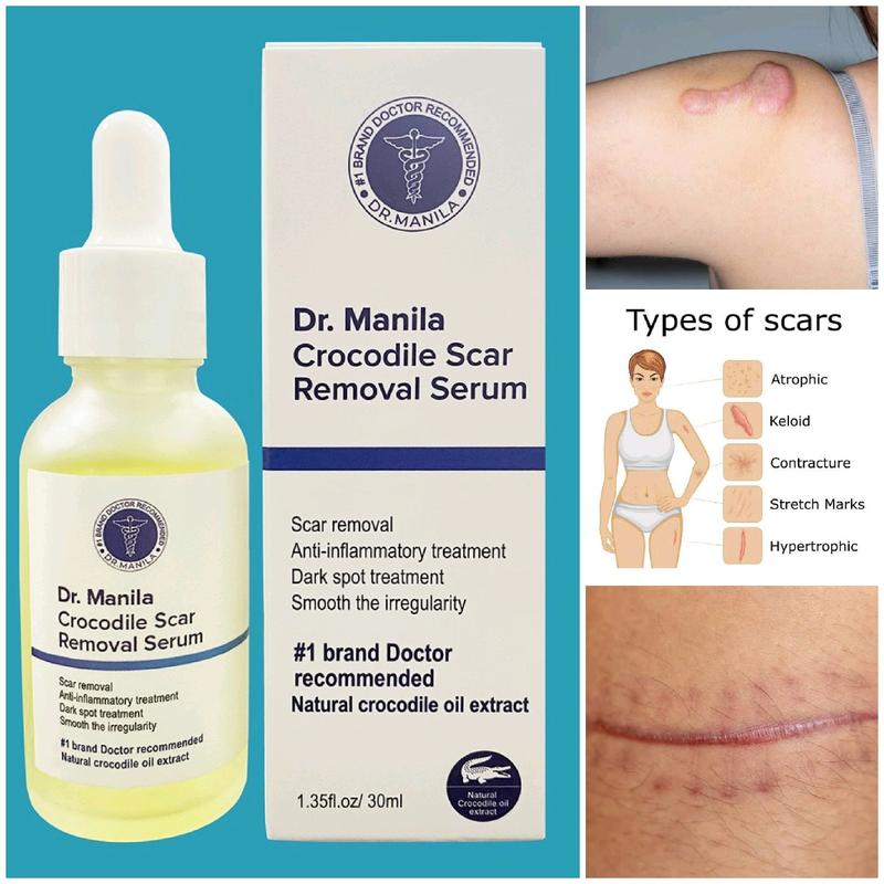 Dr. Manila Crocodile Scar Removal Serum All Skin Types Fragrance ...